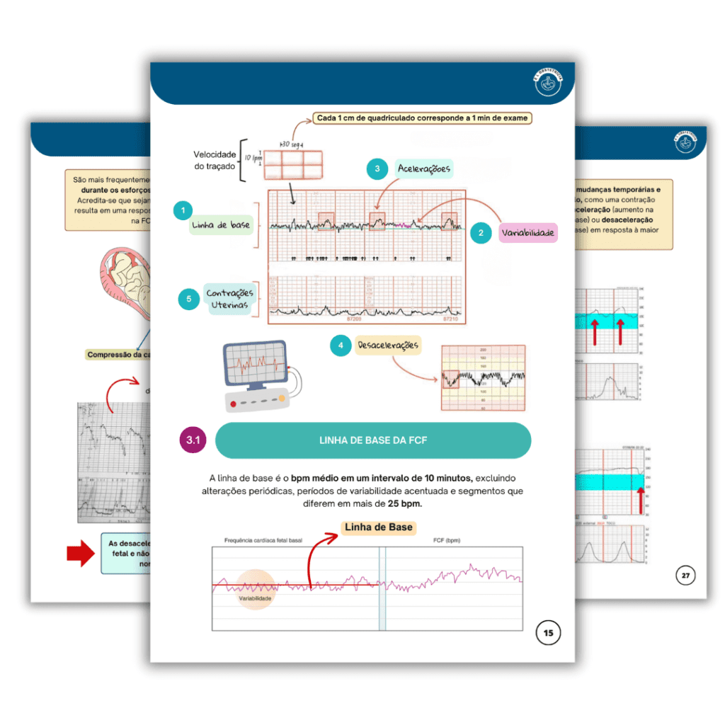 cardiotocografia – elobstetricia