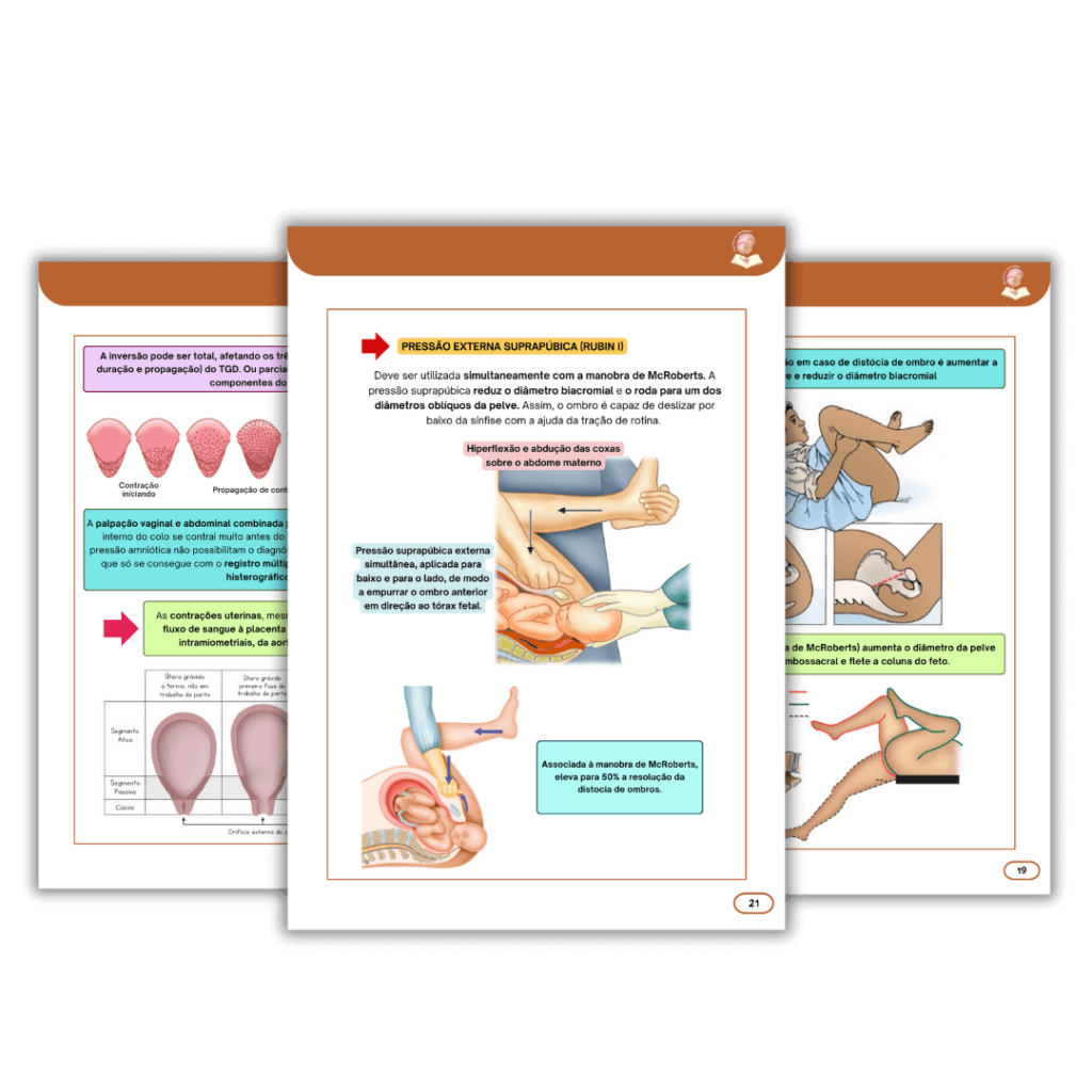 Distocias – elobstetricia